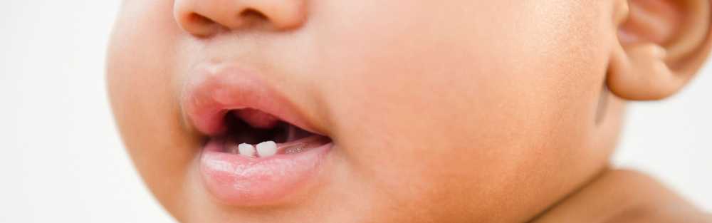 Teething Symptoms & Teething Pain Relief Remedies | Nurofen AU